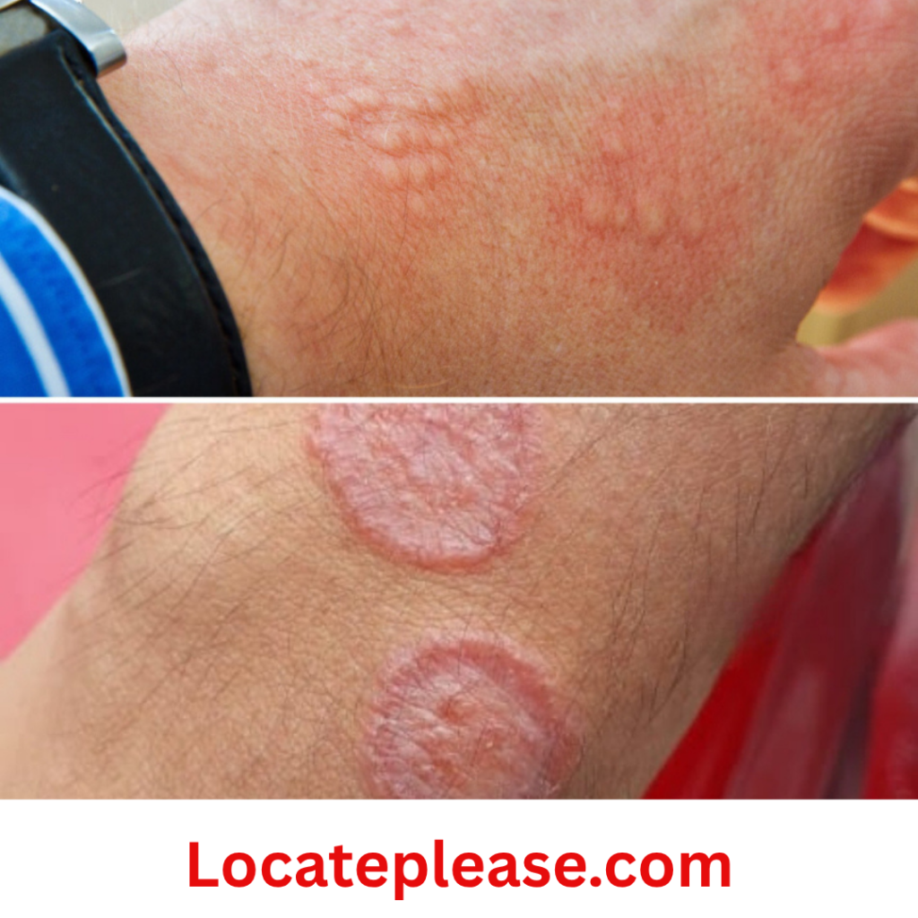 Signs of Groin Skin Irritation: Causes, Symptoms, and Gentle Care ...